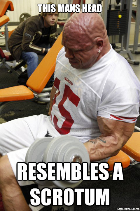 this mans head resembles a scrotum - Misc - quickmeme
