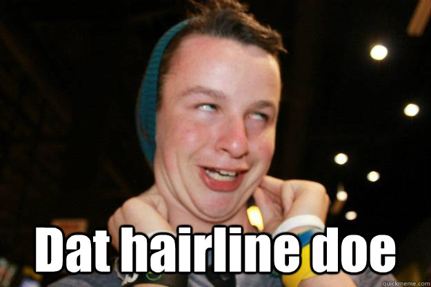 Dat hairline doe - Awkward Charlie - quickmeme