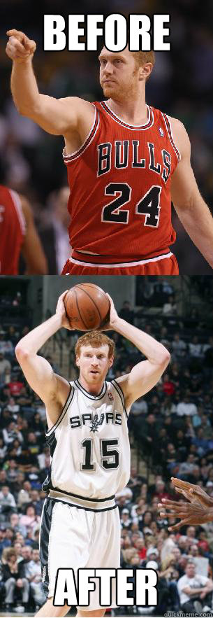 before after - Misc - quickmeme